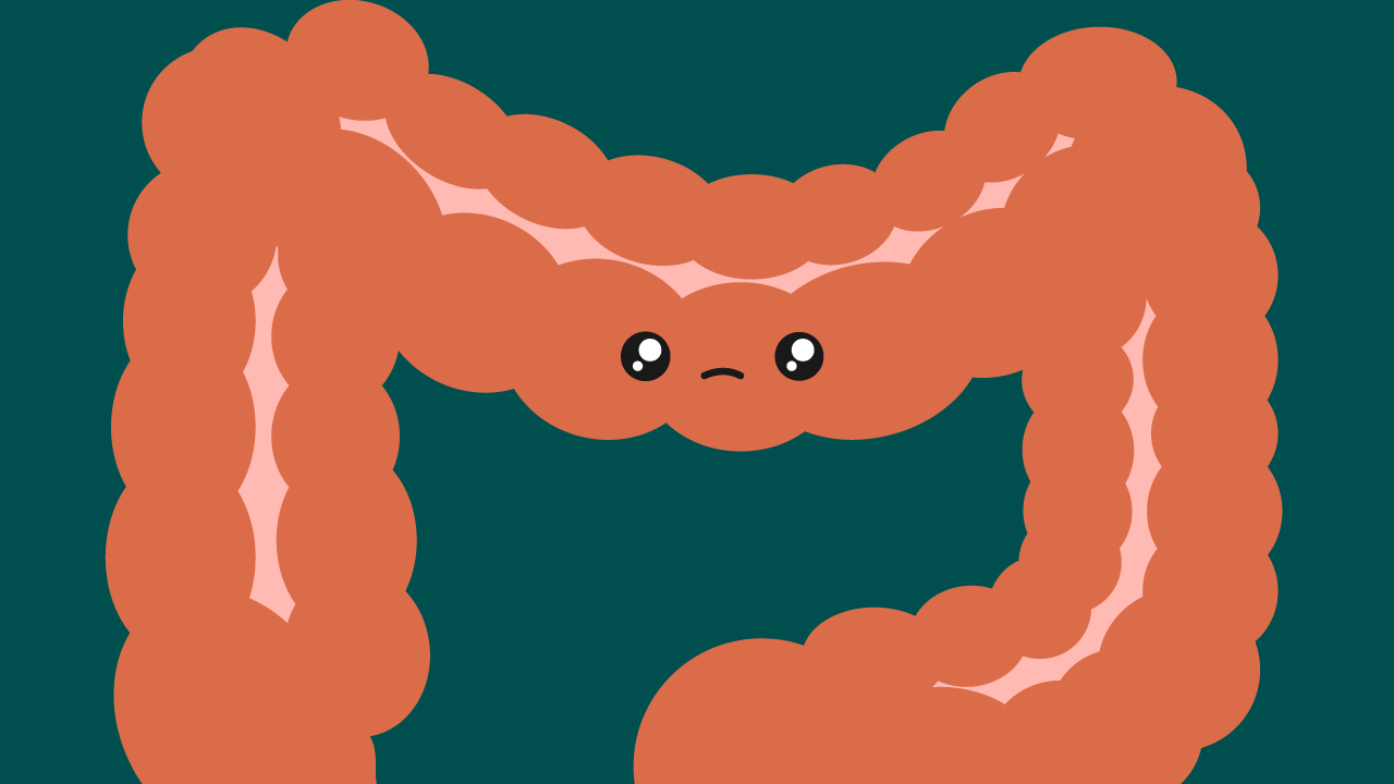 ¿Qué es el cáncer colorrectal? - +Salud FacMed